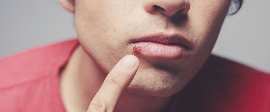 ℹ VPH en hombres y mujeres: ¿Cómo debe ser el tratamiento en una ...